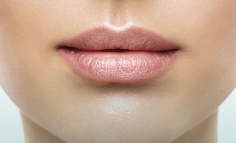 Aspectos da anatomia labial a serem considerados para um preenchimento ...