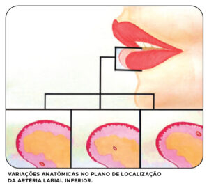 Aspectos da anatomia labial a serem considerados para um preenchimento ...