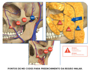 Os efeitos do preenchimento da região malar na reestruturação da face ...